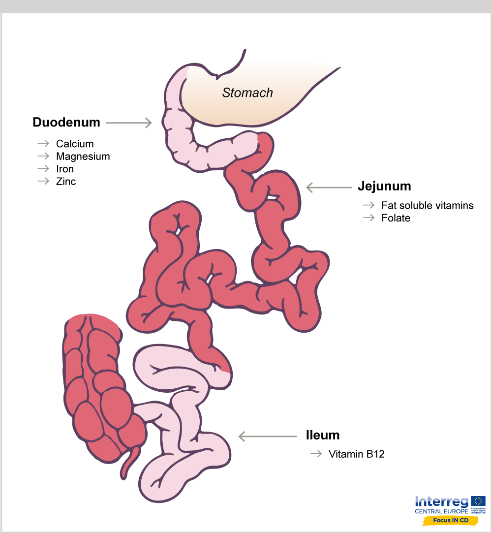Celiac Facts for Patients: Lesson 3: How Healthy is the Glutenfree Diet ...